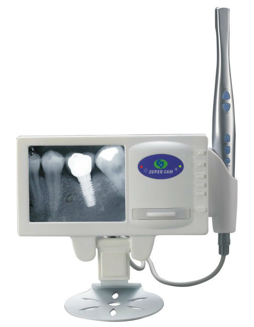 Intraoral Camera – National Veneer Dentist